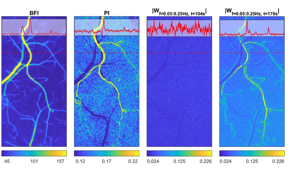Imaging study reveals how tiny brain vessels pulse to regulate blood flow